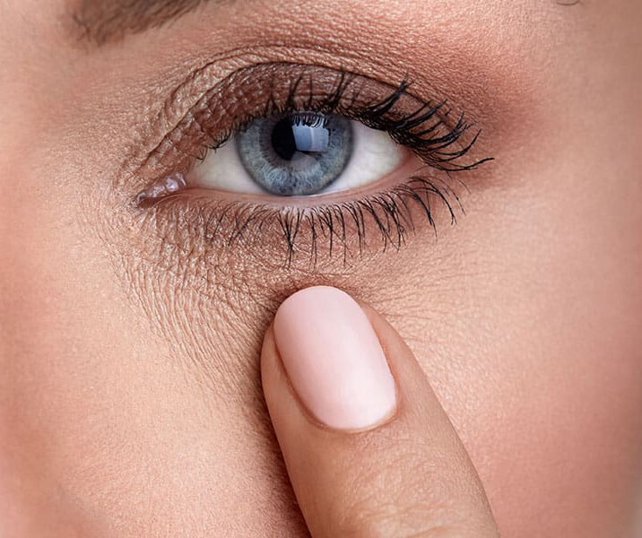 Ectropion - What is an ectropion | Symptoms & Treatment